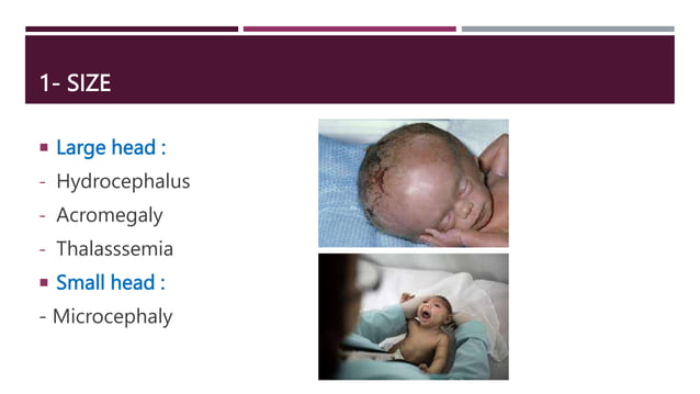 head and face examination part 1555.pptx