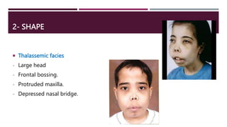 head and face examination part 1555.pptx