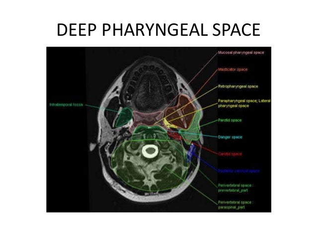 Head and Neck Imaging