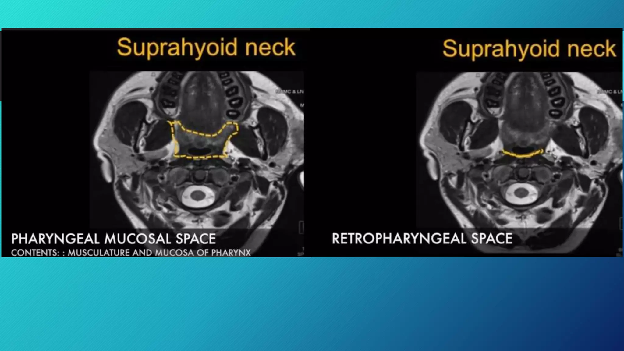 Head and neck | PPT
