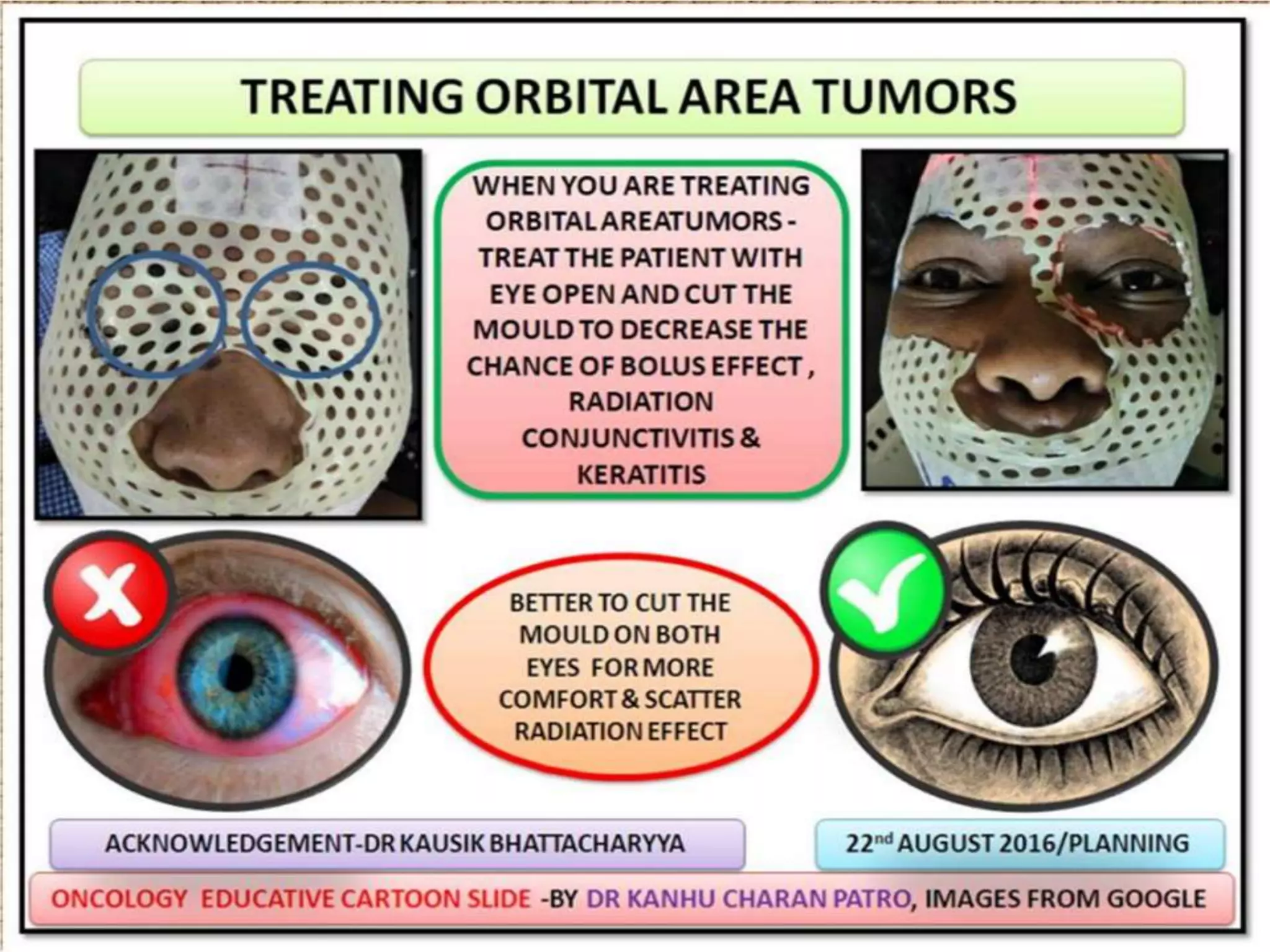 Head and neck CARTOONS | PPT