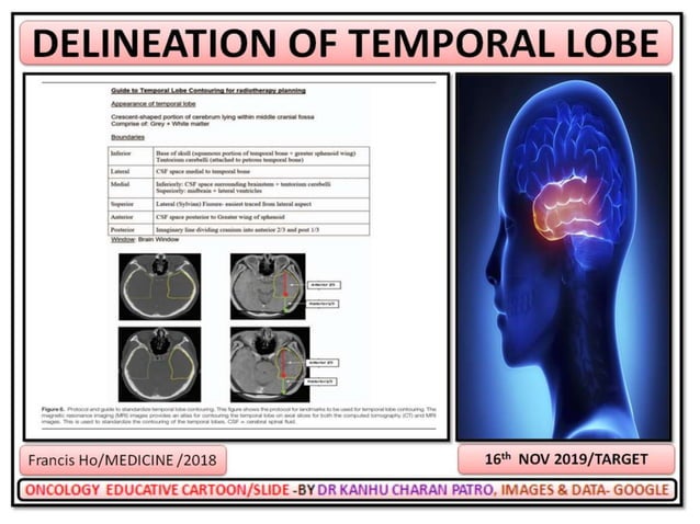 Head and neck CARTOONS | PPT