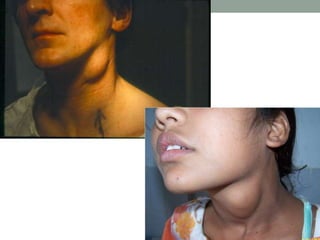 Head and neck anatomy | PPTX