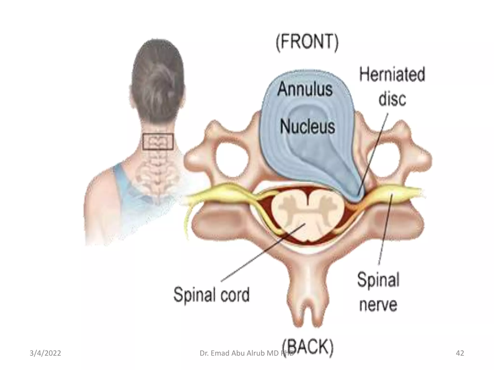 Head and neck anatomy 1 skull & neck bones | PPTX