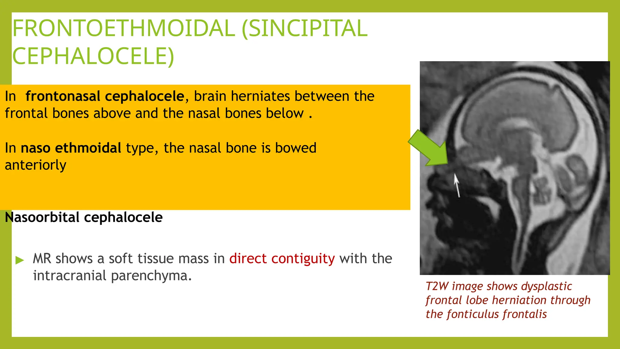 head and neck masses power point presentation | PPTX