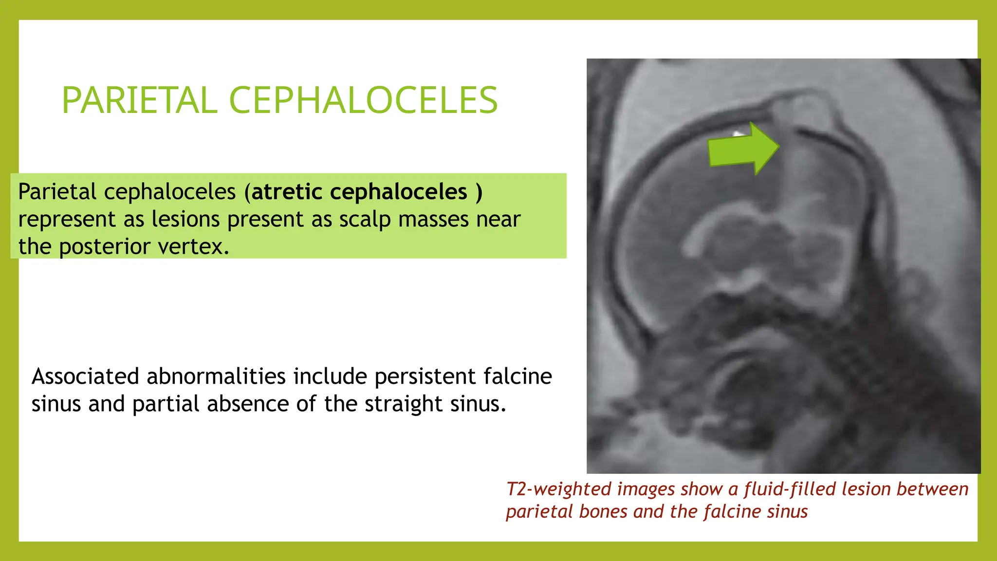 head and neck masses power point presentation | PPTX