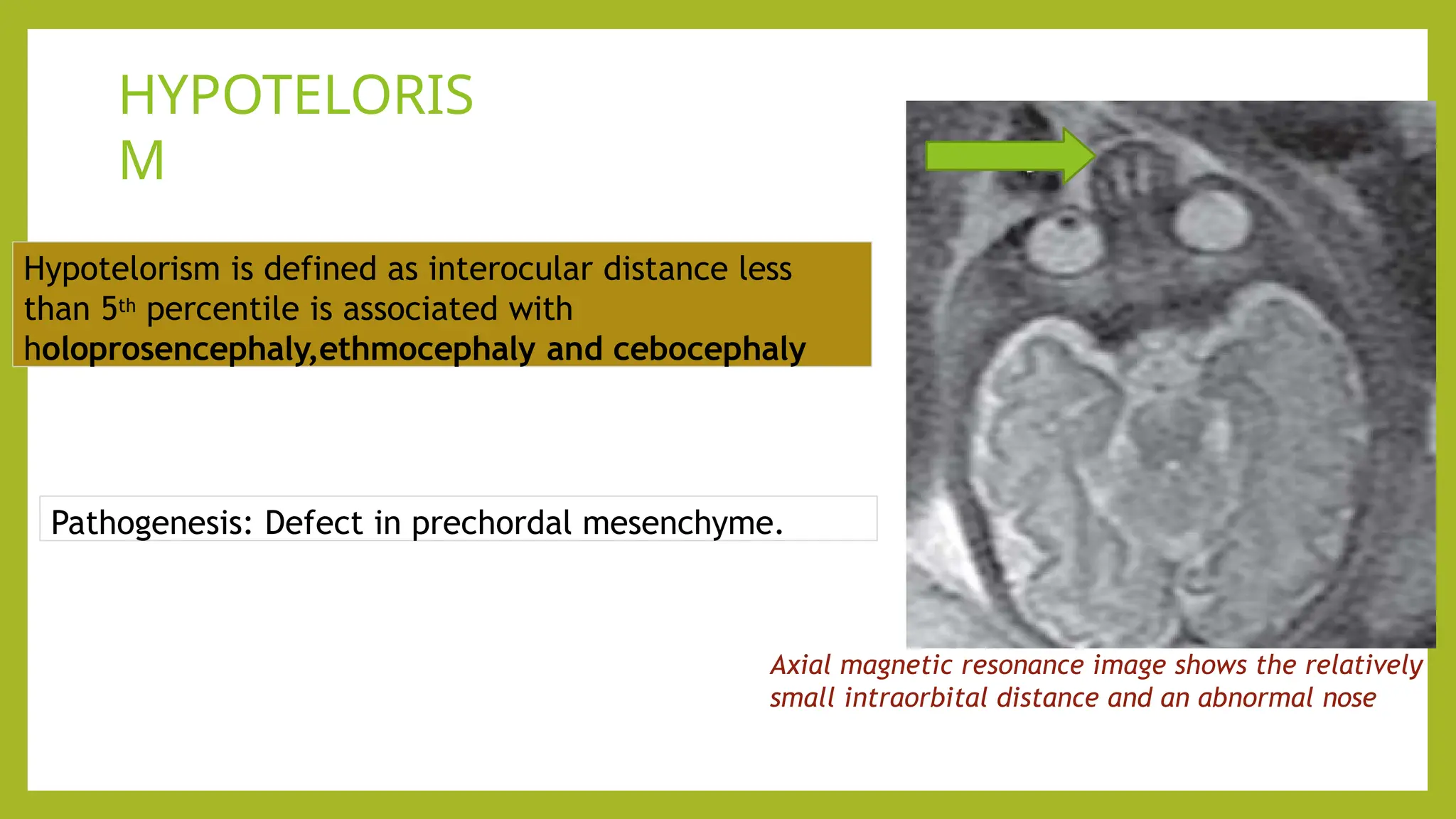 head and neck masses power point presentation | PPTX