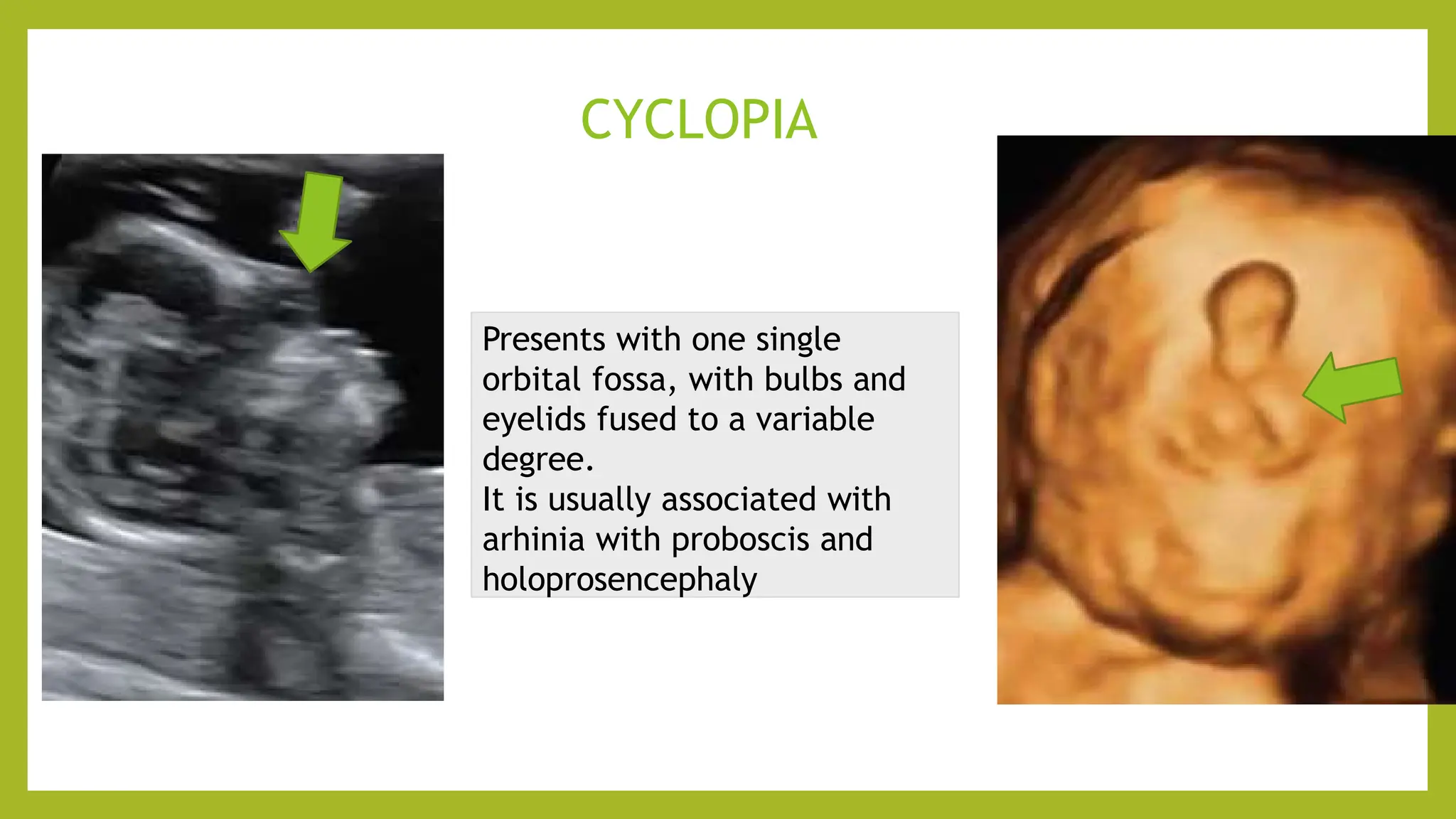 head and neck masses power point presentation | PPTX