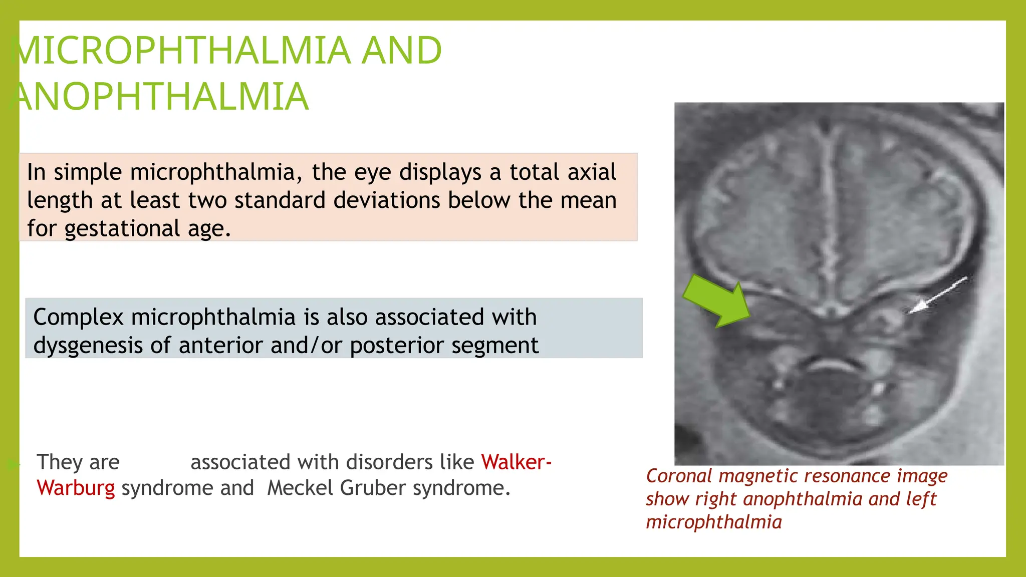 head and neck masses power point presentation | PPTX