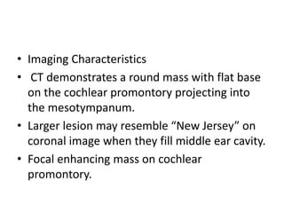 Head and neck paraganglioma | PPTX
