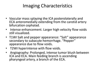 Head and neck paraganglioma | PPTX