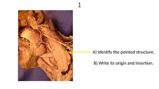 Head and neck spotters question part 1.pptx