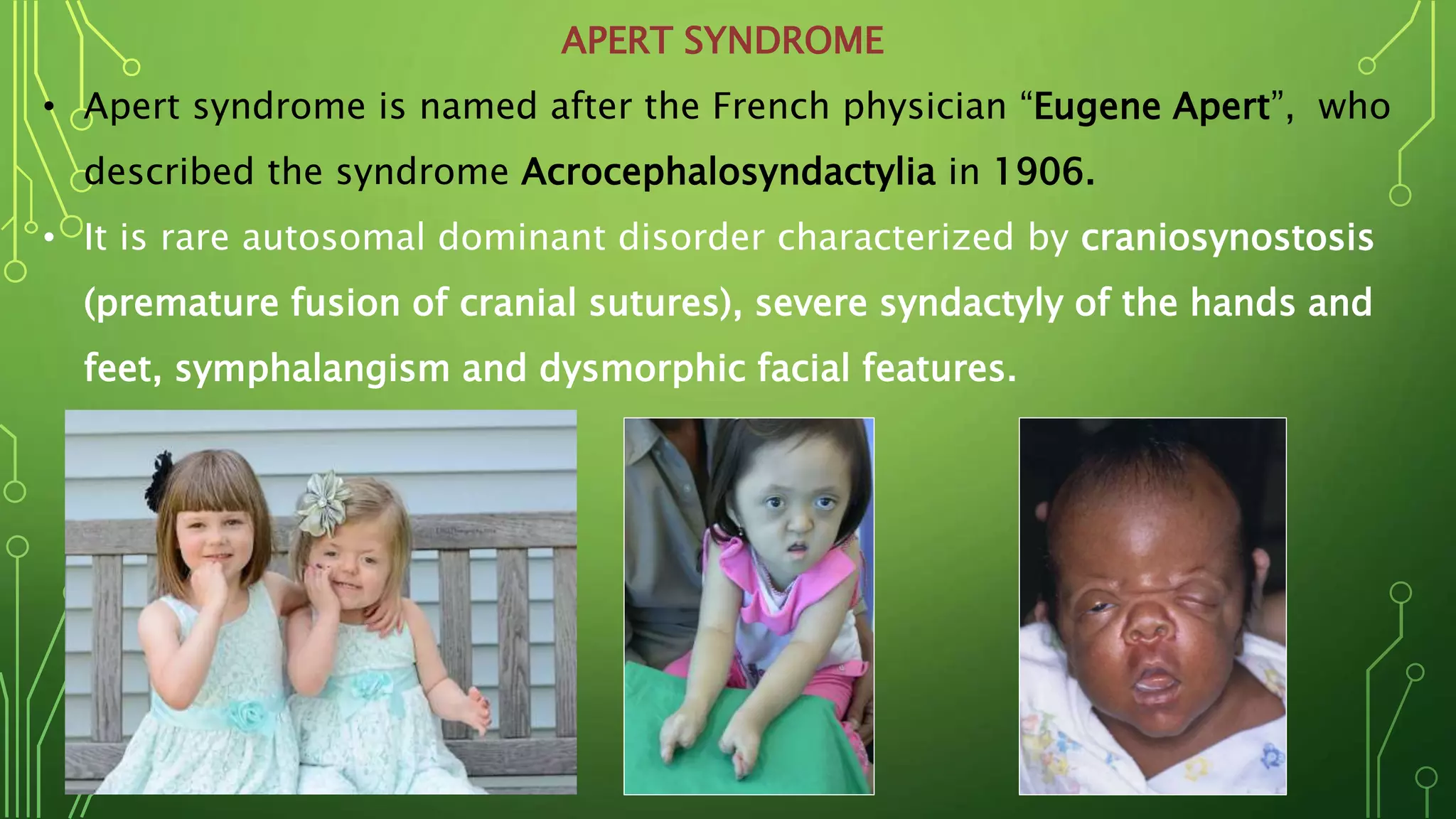 Head And Neck Syndrome | PPTX