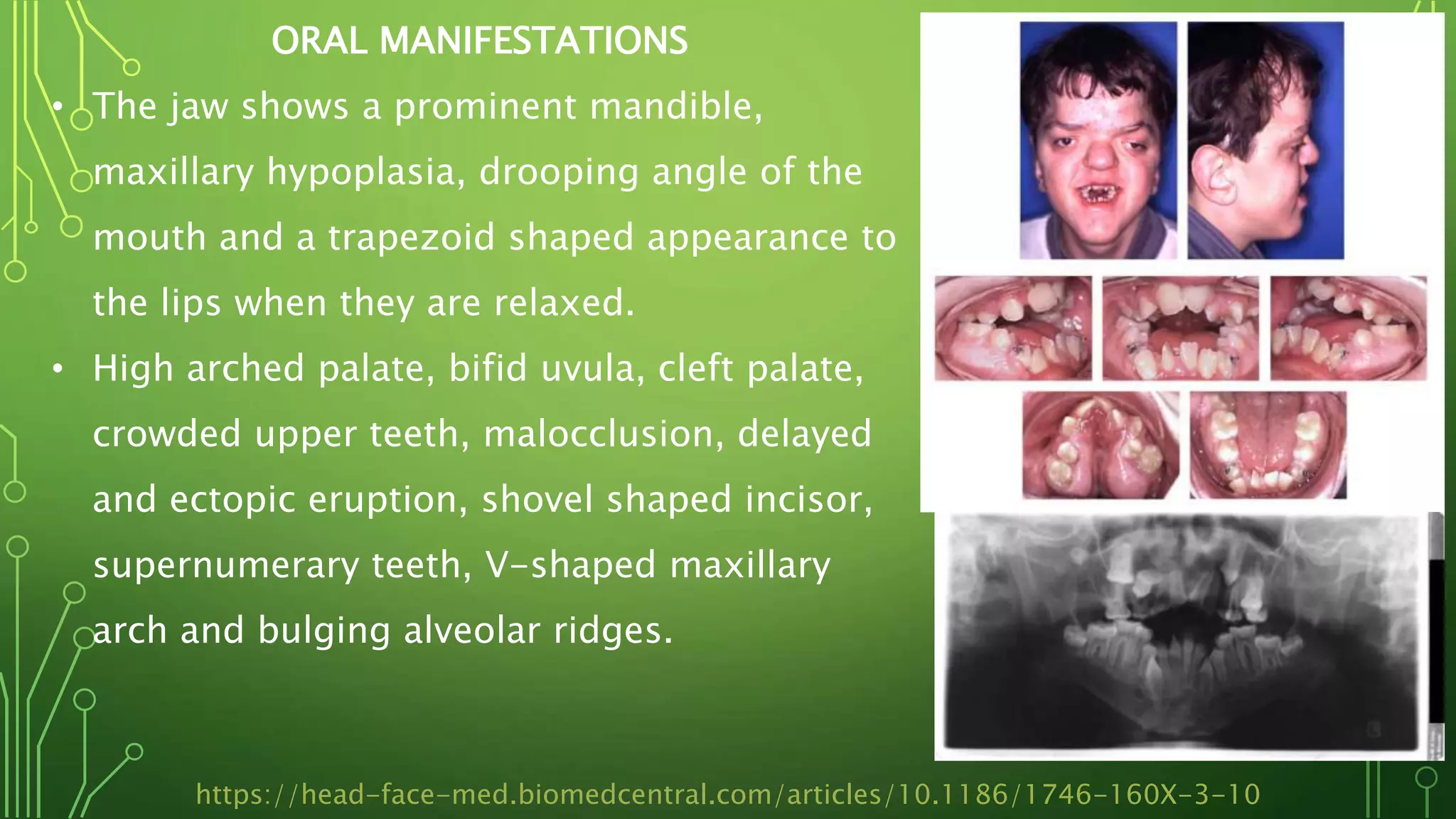 Head And Neck Syndrome | PPTX