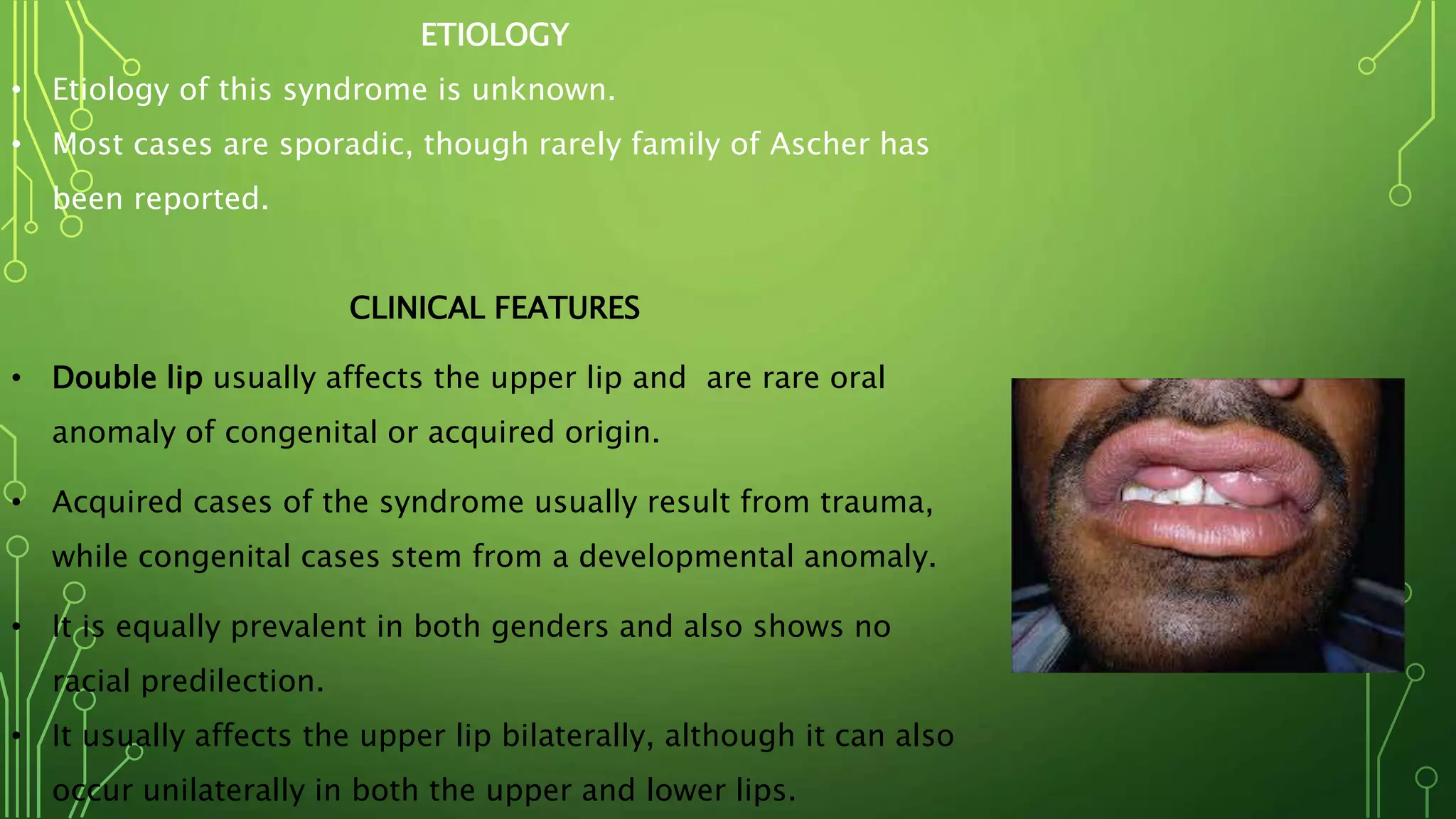 Head And Neck Syndrome | PPTX