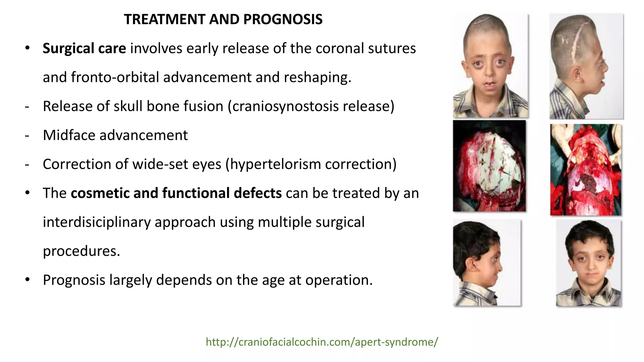 Syndrome / Head and Neck Syndrome | PPTX
