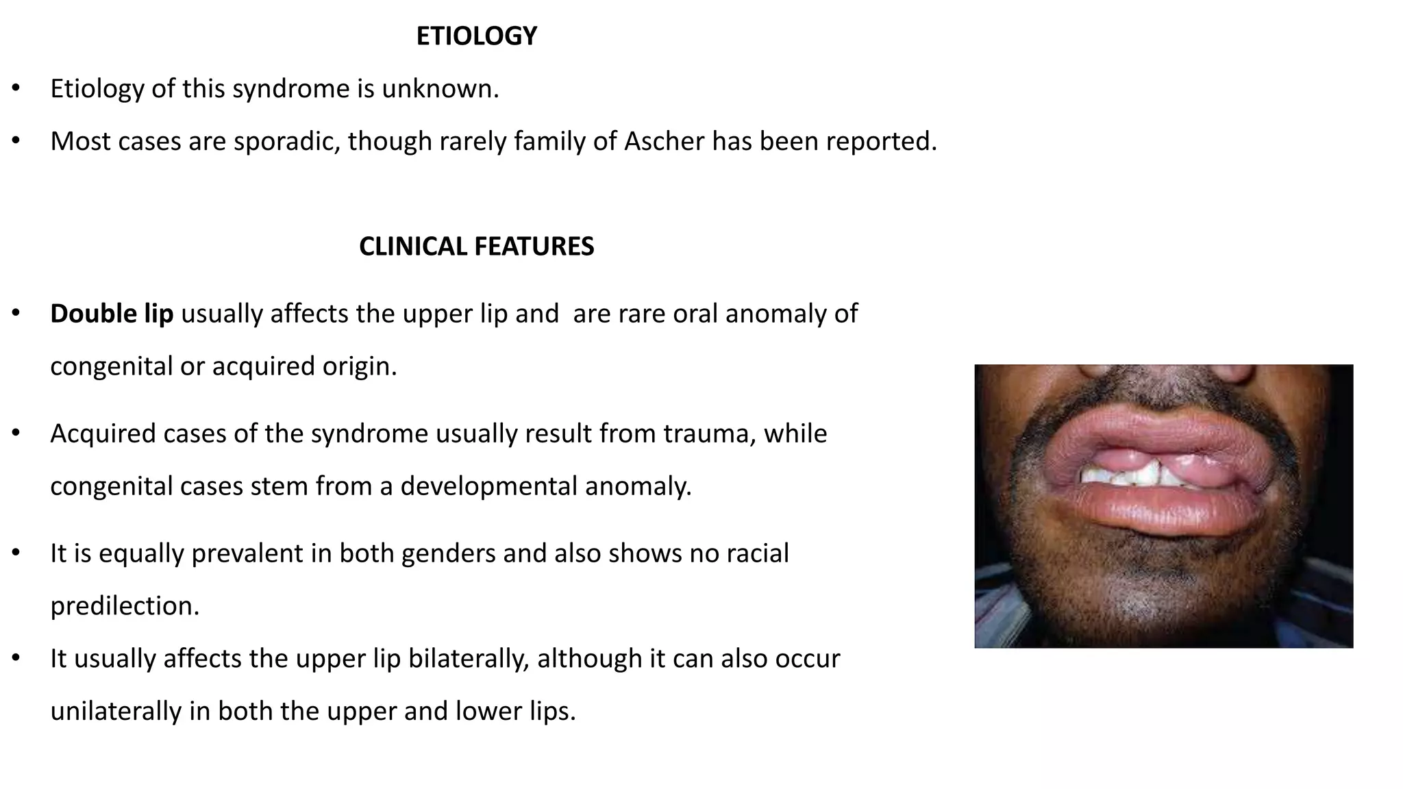 Syndrome / Head and Neck Syndrome | PPTX