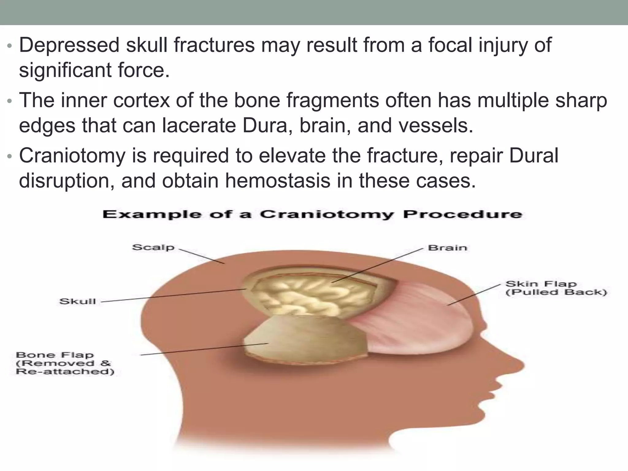 Head and neck trauma | PPTX