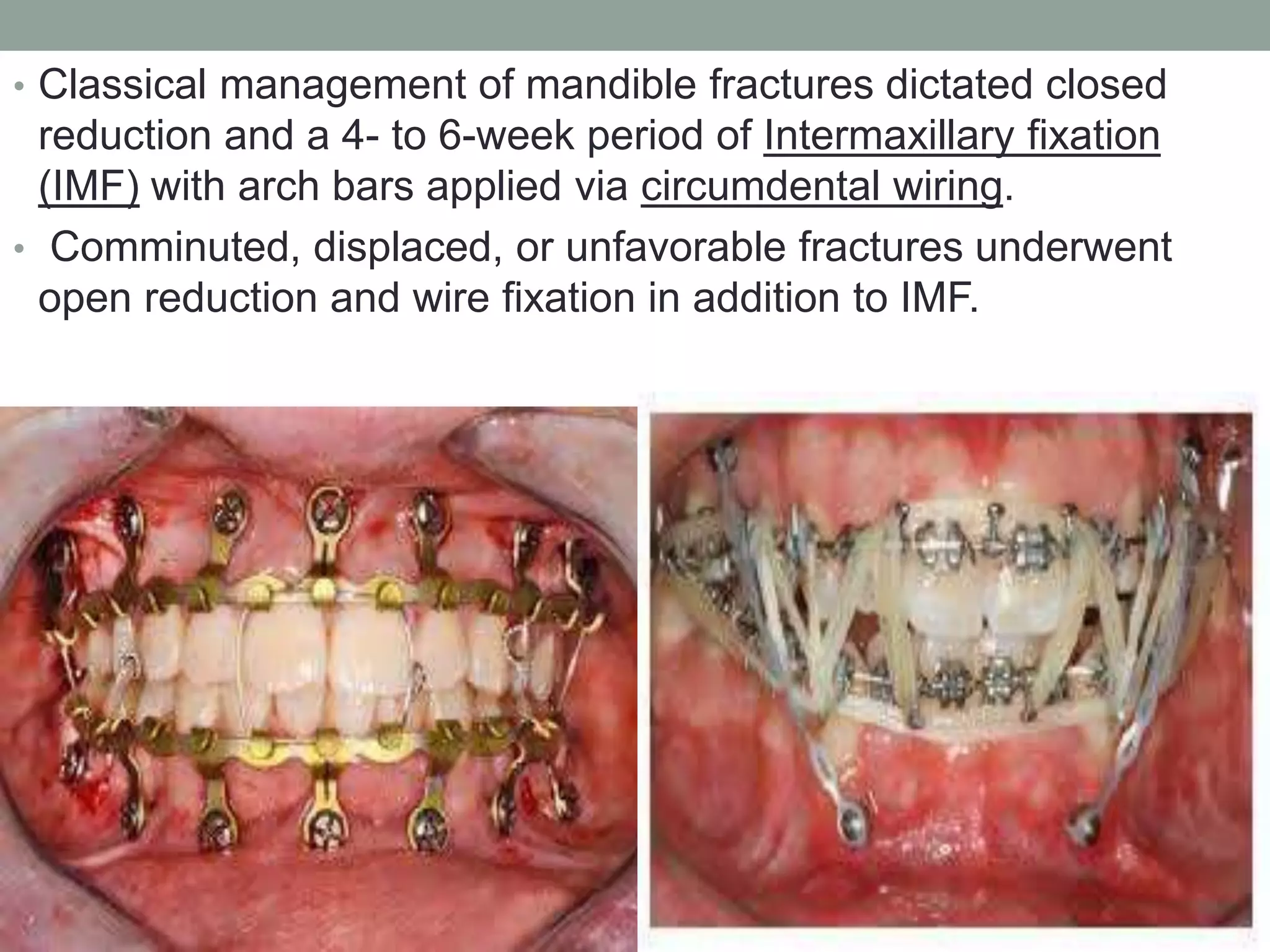 Head and neck trauma | PPTX