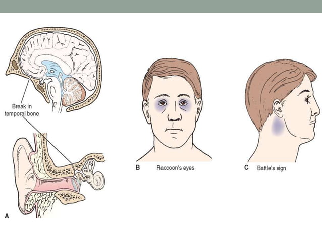 Head and neck trauma