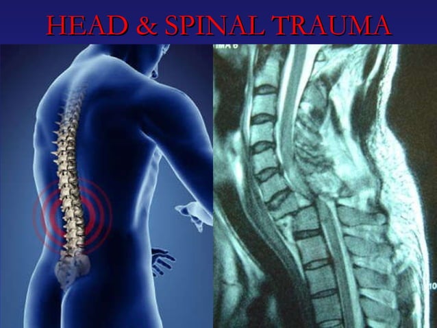 HEAD & SPINAL TRAUMA | PPT