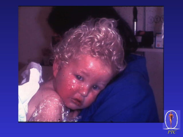 HEAD & SPINAL TRAUMA | PPT