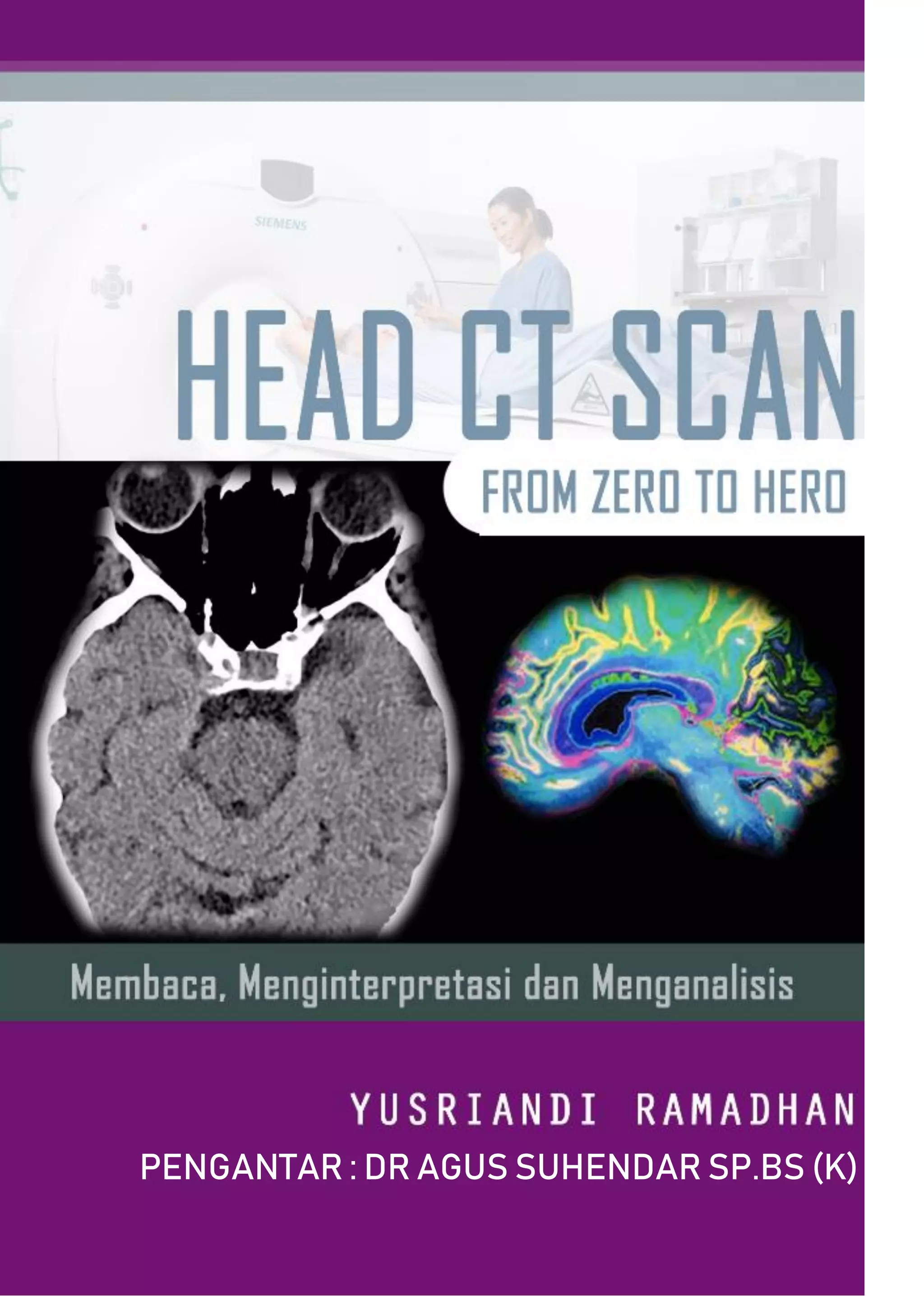 Head ct scan yusriandi ramadhan | PDF