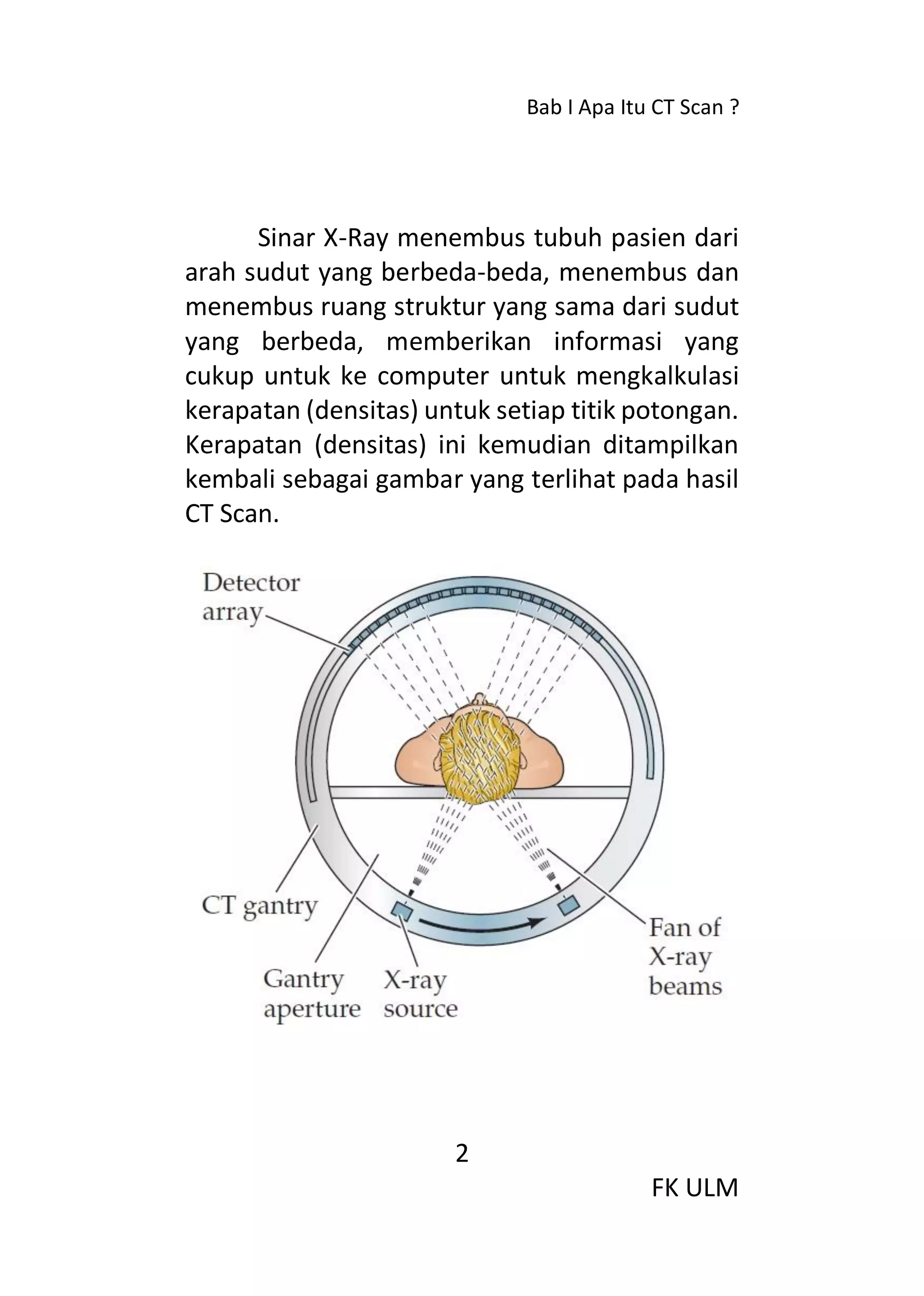 Head ct scan yusriandi ramadhan | PDF