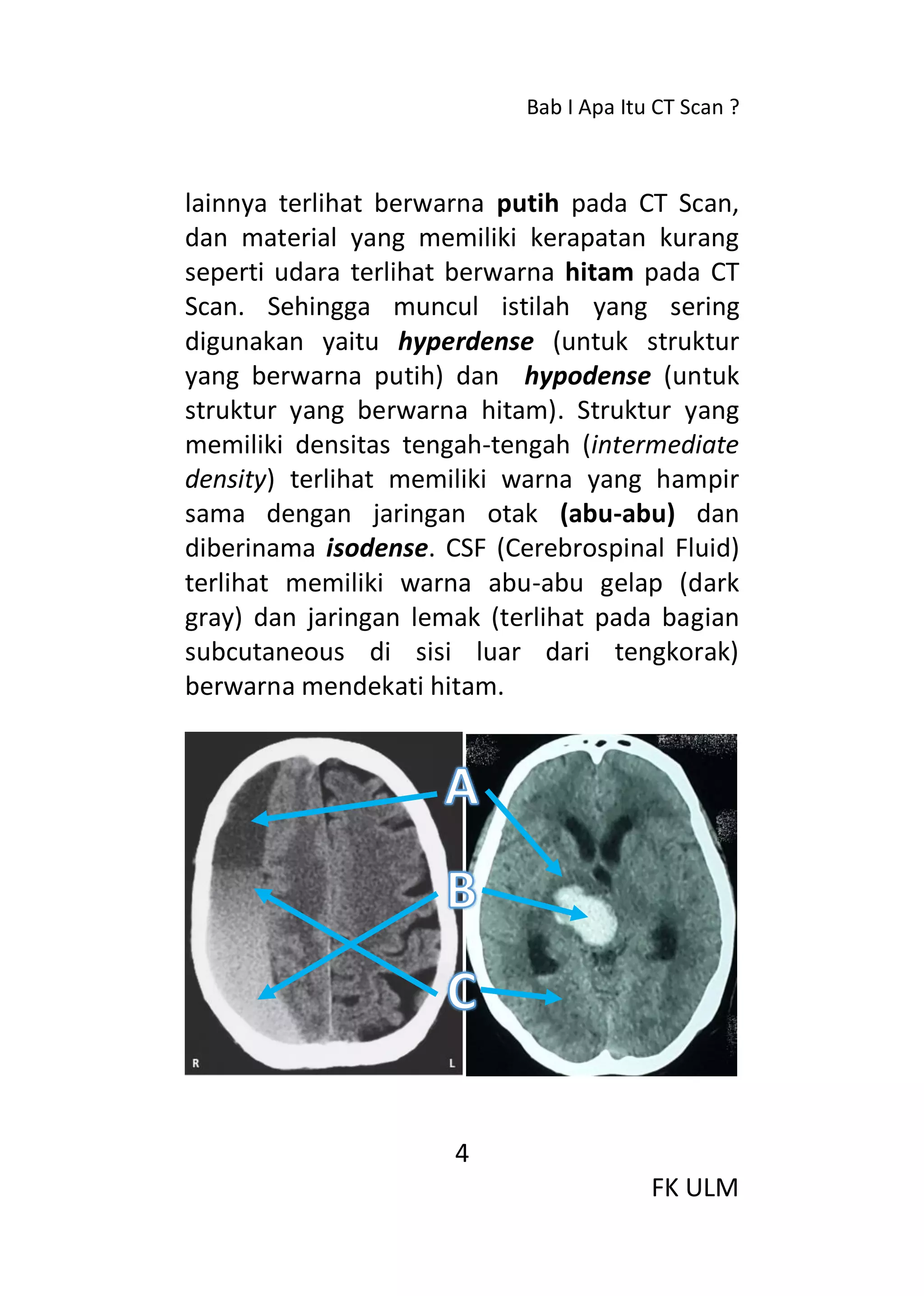 Head ct scan yusriandi ramadhan | PDF