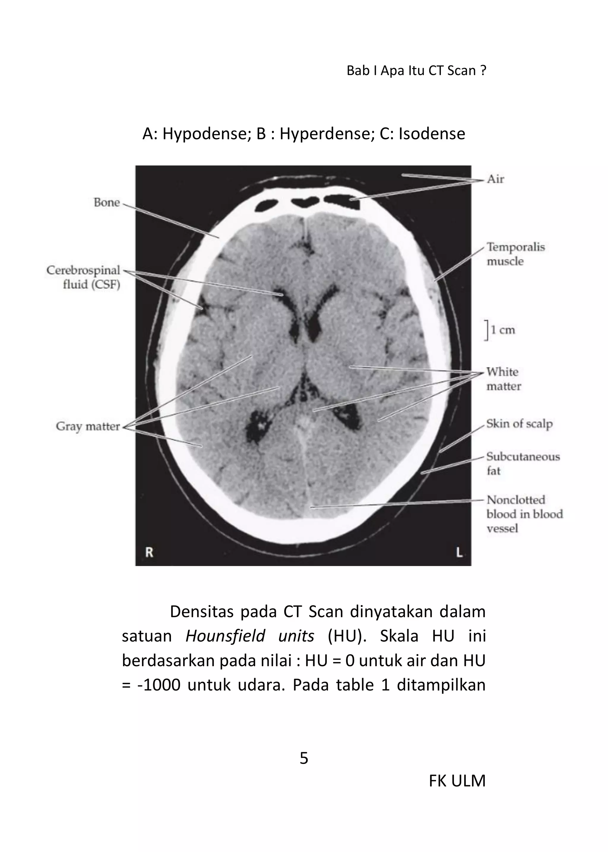 Head ct scan yusriandi ramadhan | PDF