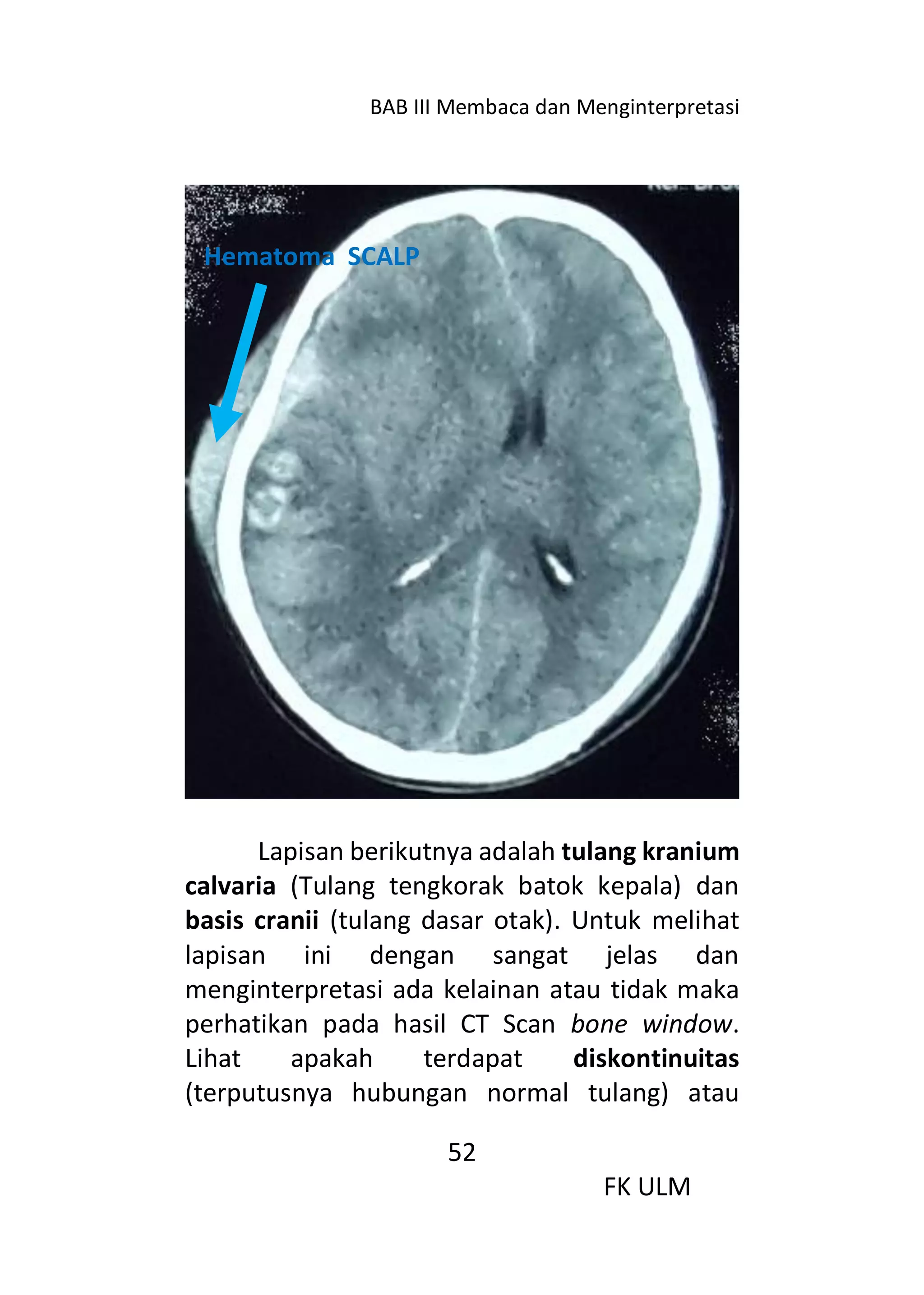 Head ct scan yusriandi ramadhan | PDF