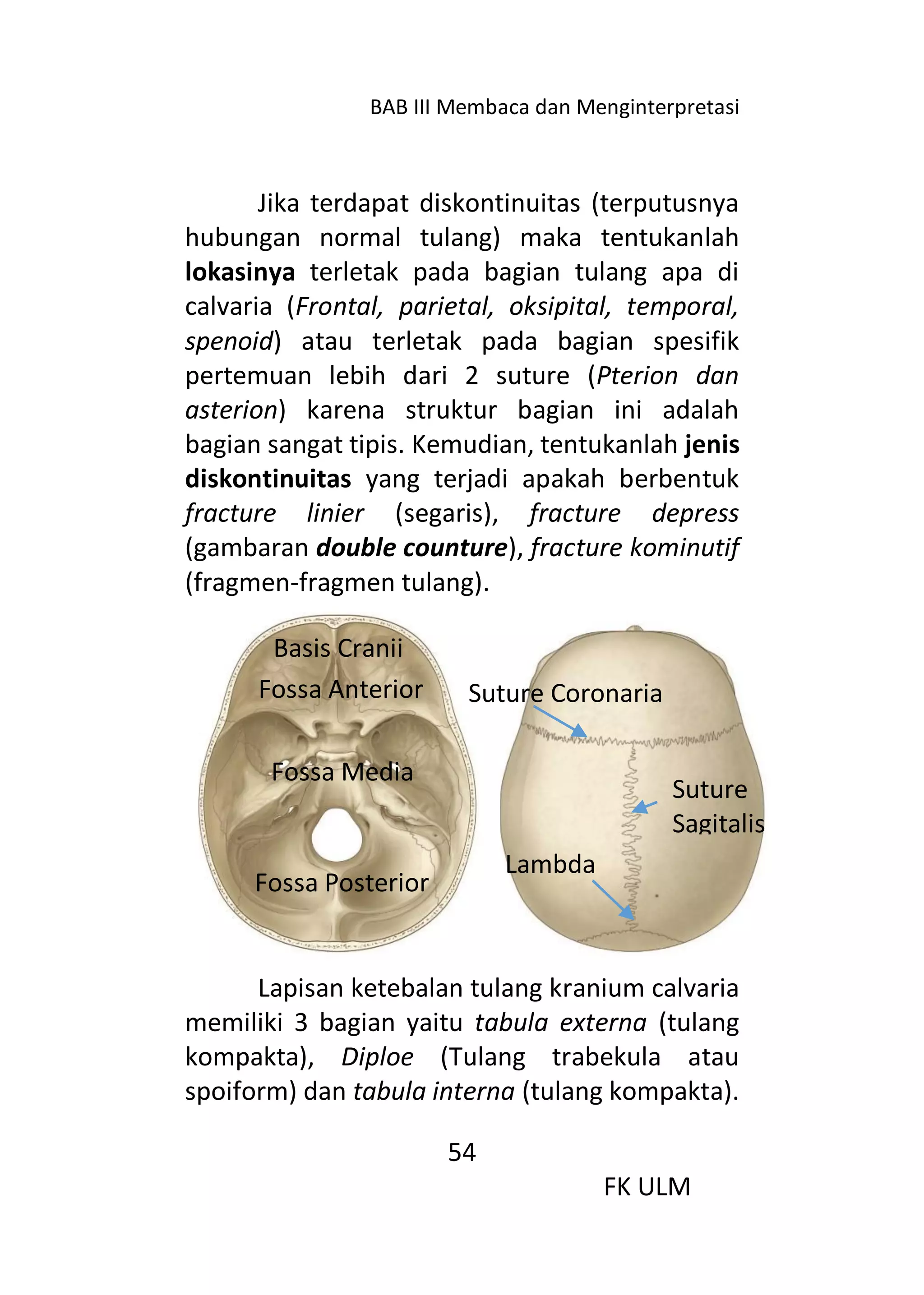 Head ct scan yusriandi ramadhan | PDF