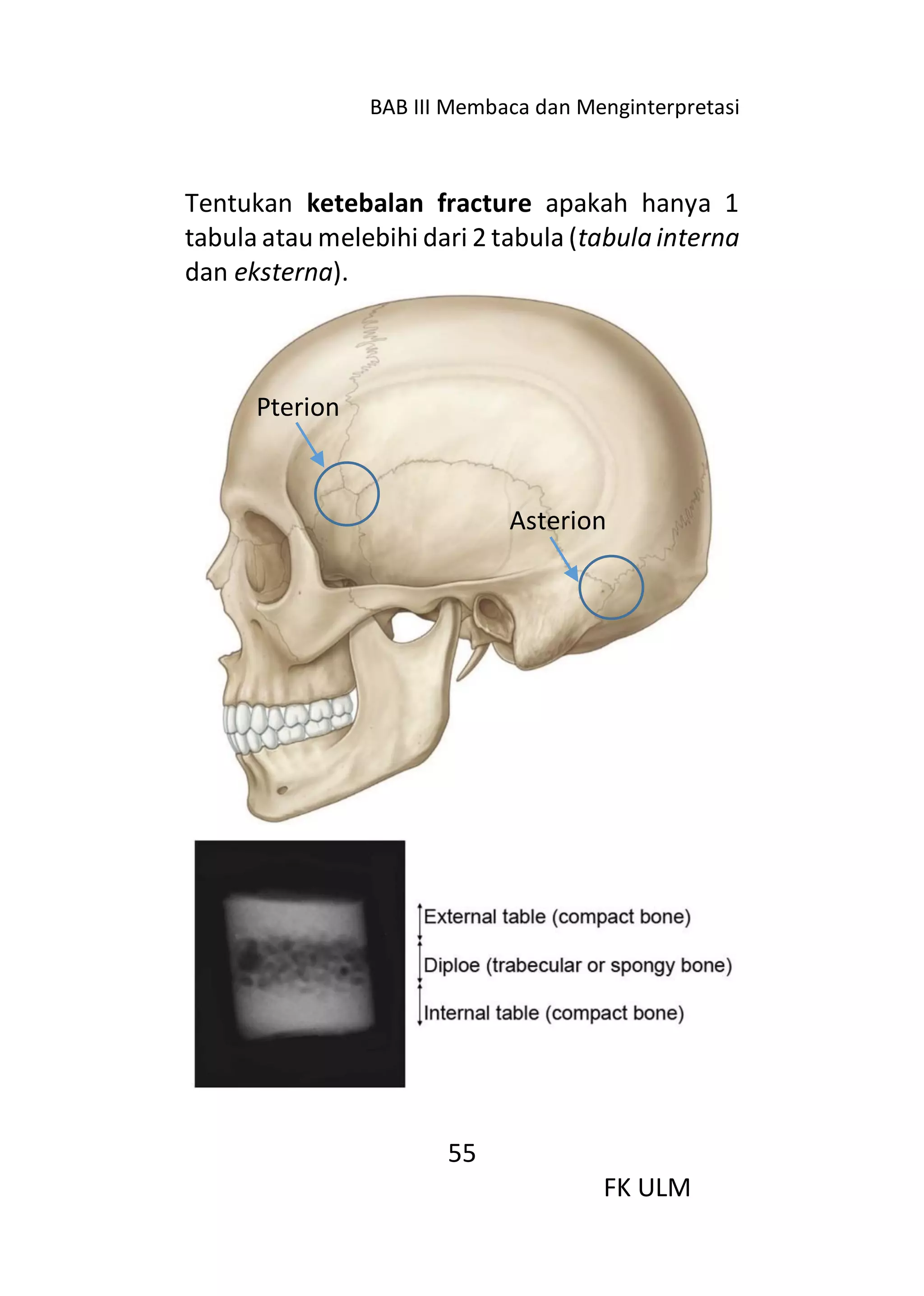Head ct scan yusriandi ramadhan | PDF