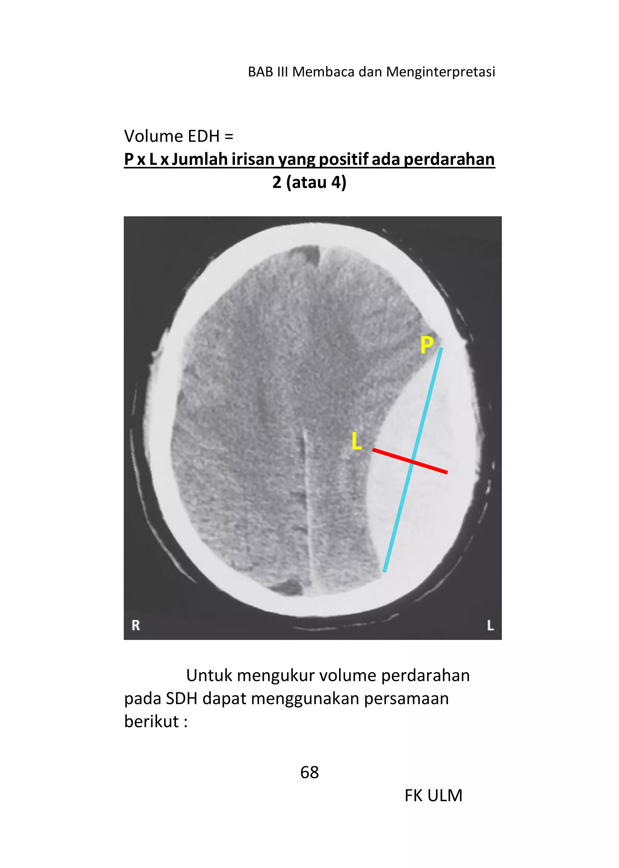 Head ct scan yusriandi ramadhan | PDF