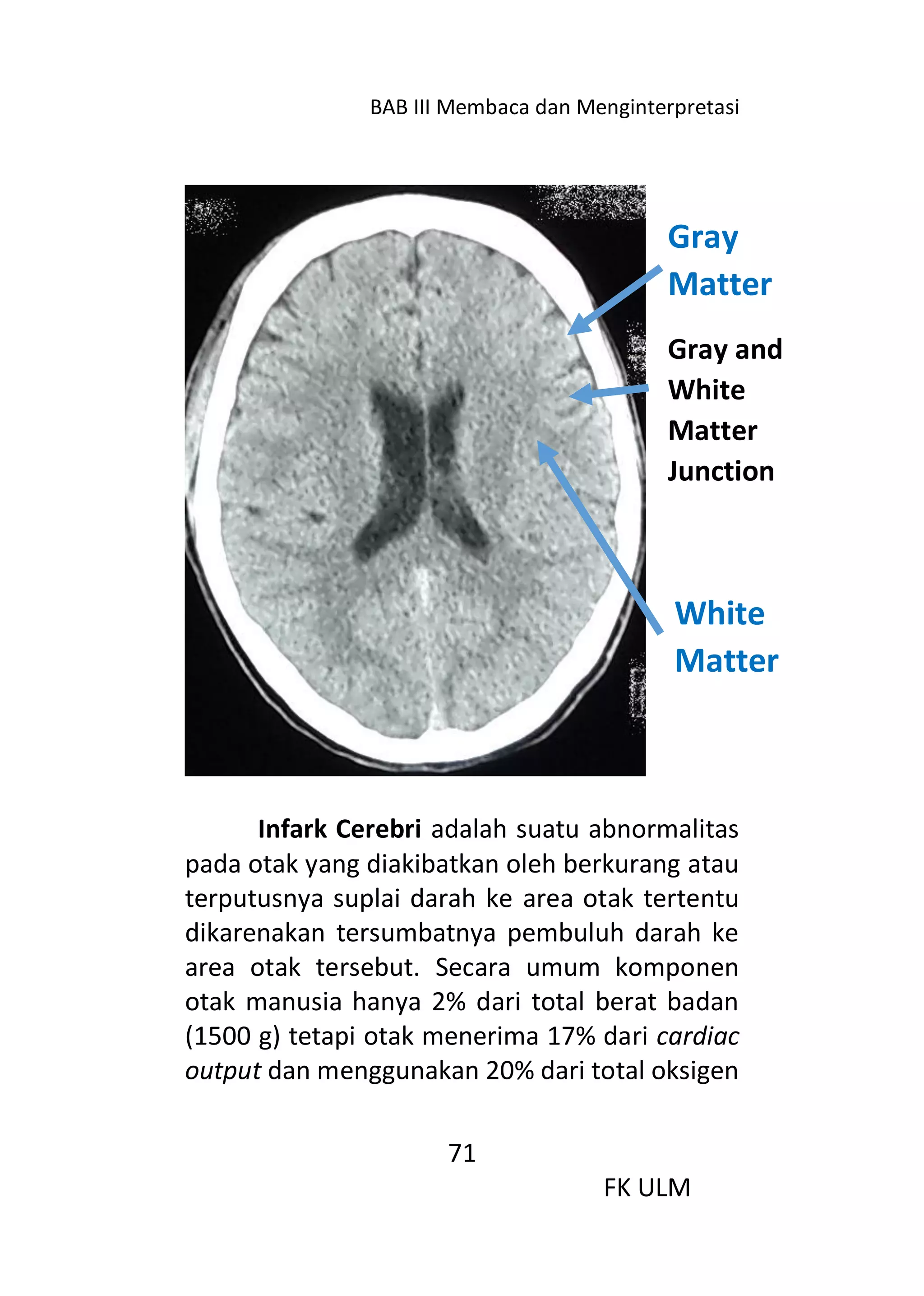 Head ct scan yusriandi ramadhan | PDF