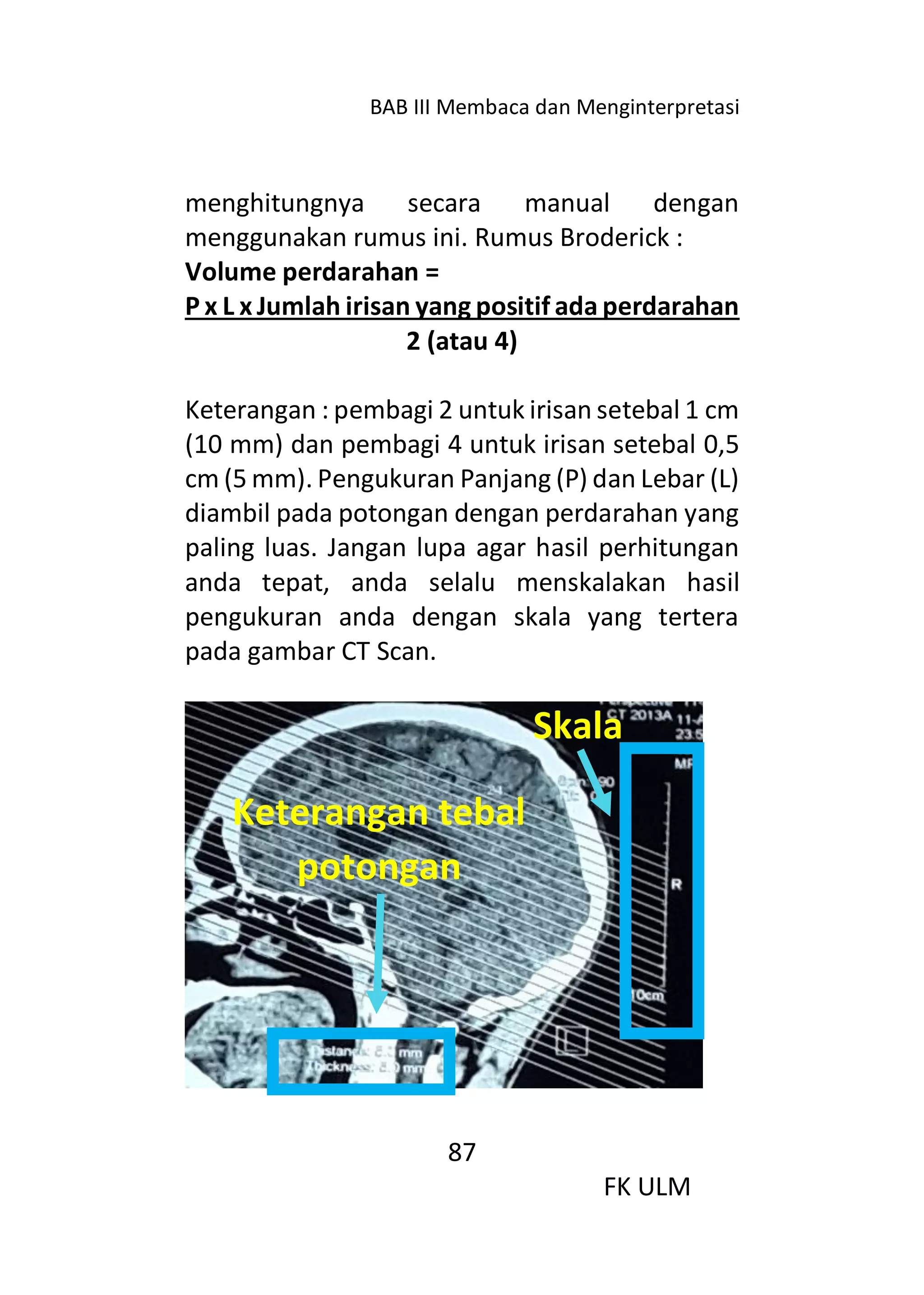 Head ct scan yusriandi ramadhan | PDF