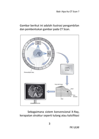 Head ct scan yusriandi ramadhan | PDF