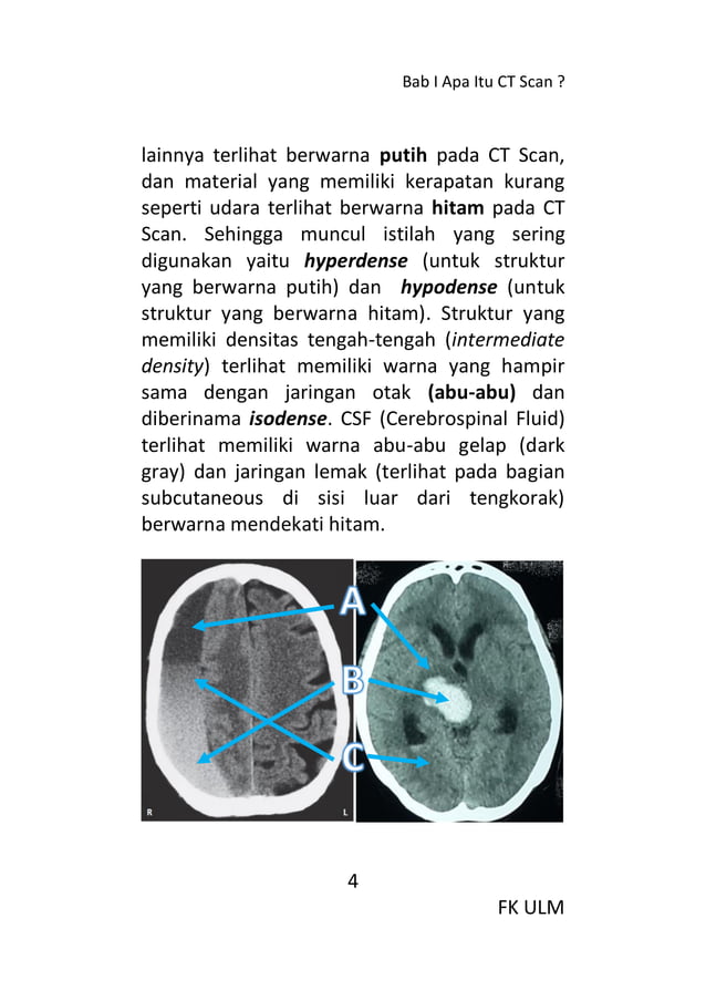 Head ct scan yusriandi ramadhan | PDF