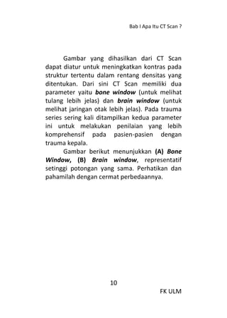 Head ct scan yusriandi ramadhan | PDF