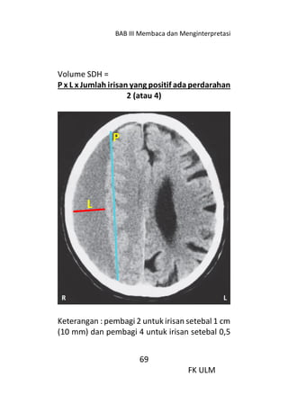 Head ct scan yusriandi ramadhan | PDF