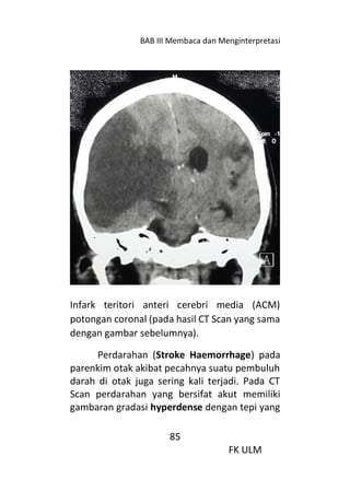 Head ct scan yusriandi ramadhan | PDF