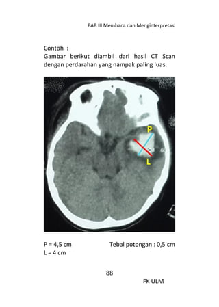 Head ct scan yusriandi ramadhan | PDF