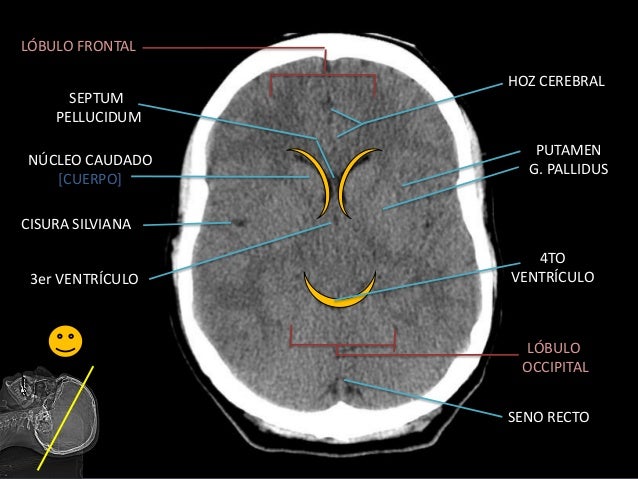 NEUROTAC ANATOMIA BASICA DR. MENDOZA Y JOB