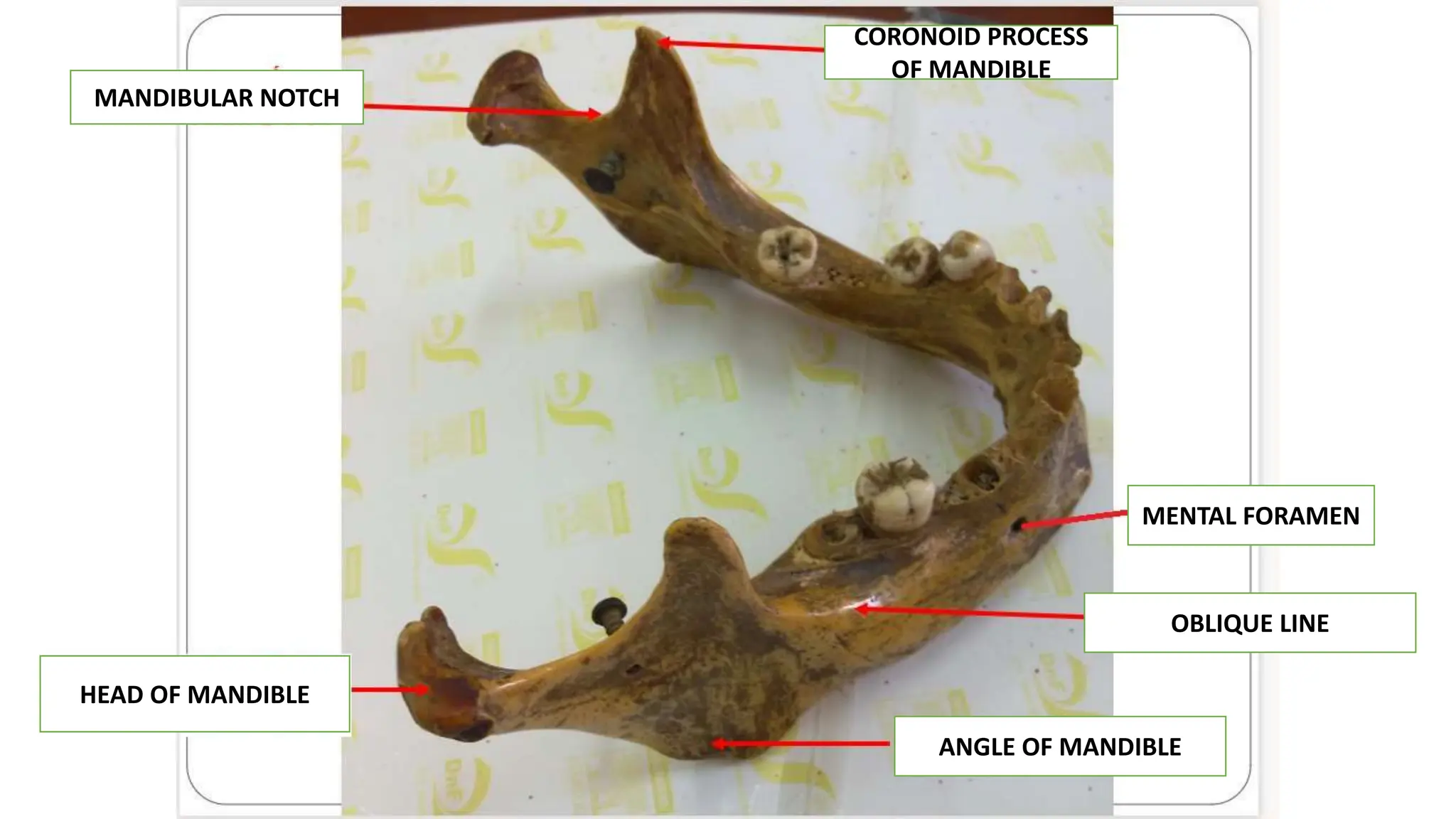 HEAD, FACE AND NECK PRACTICAL-1.pptx to you | PPTX