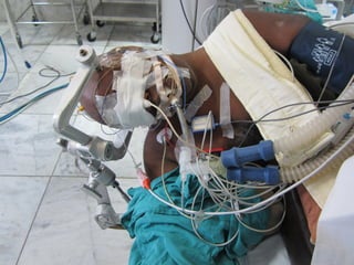 Head Fixation and Positioning in Neurosurgery.pptx