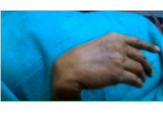 Head Fixation and Positioning in Neurosurgery.pptx