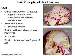 Head Fixation and Positioning in Neurosurgery.pptx