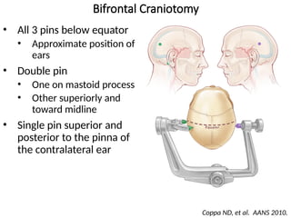 Head Fixation and Positioning in Neurosurgery.pptx