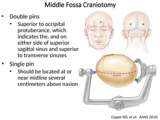 Head Fixation and Positioning in Neurosurgery.pptx