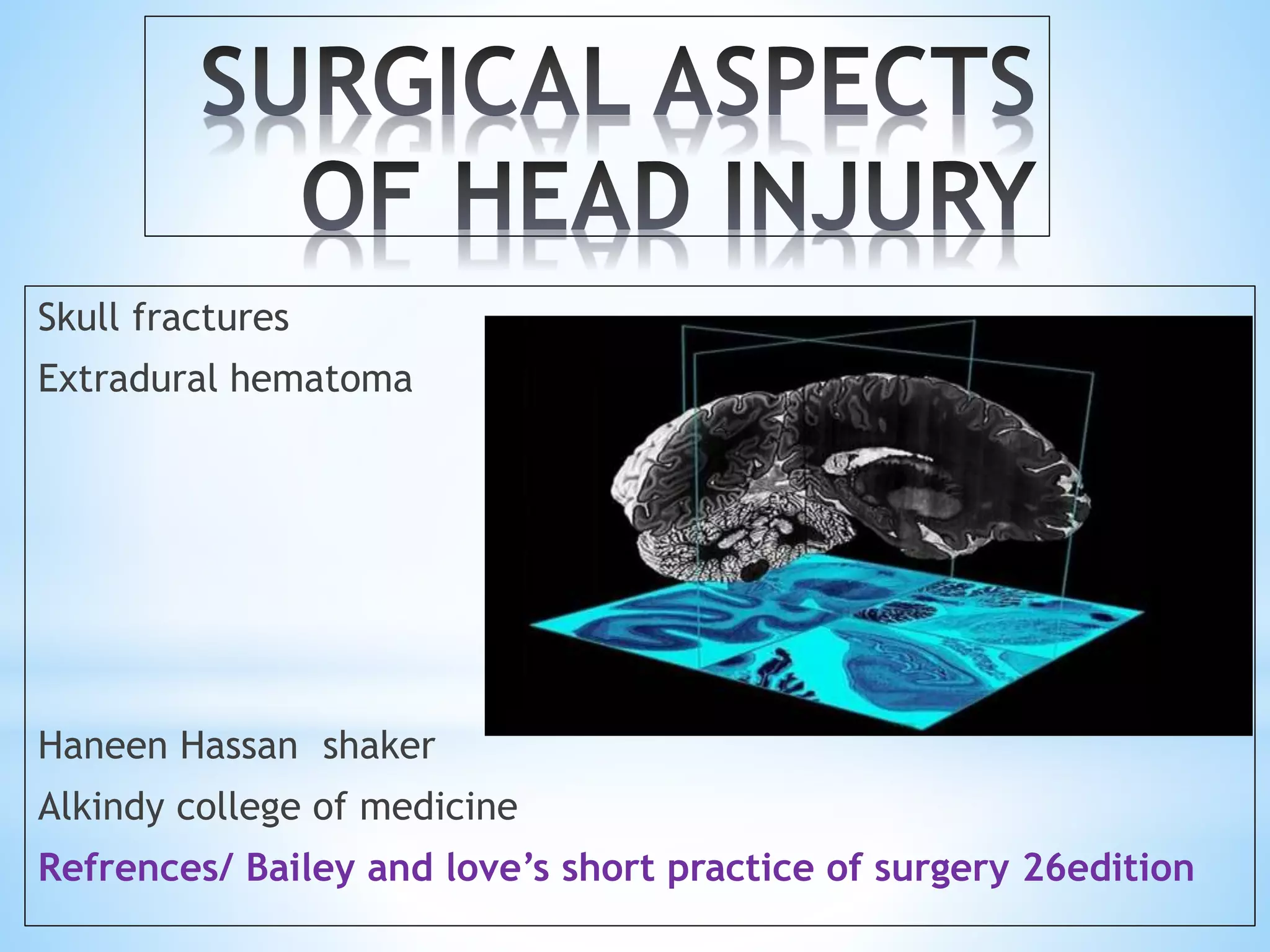 Head fractures & ;extradural hematoma | PPT